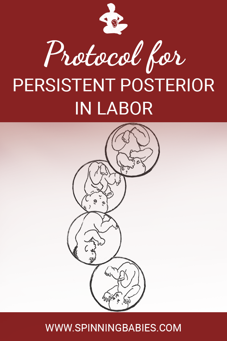 Protocol for Persistent Posterior in Labor - Spinning Babies
